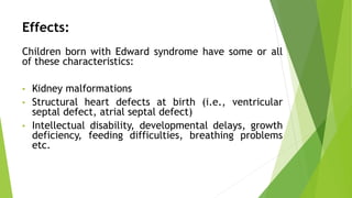 The Presentation on Edwards syndrome.pptx