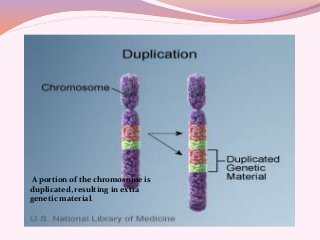 Edward’s syndrome (Trisomy 18) | PPTX