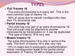 Edward’s syndrome (Trisomy 18) | PPTX