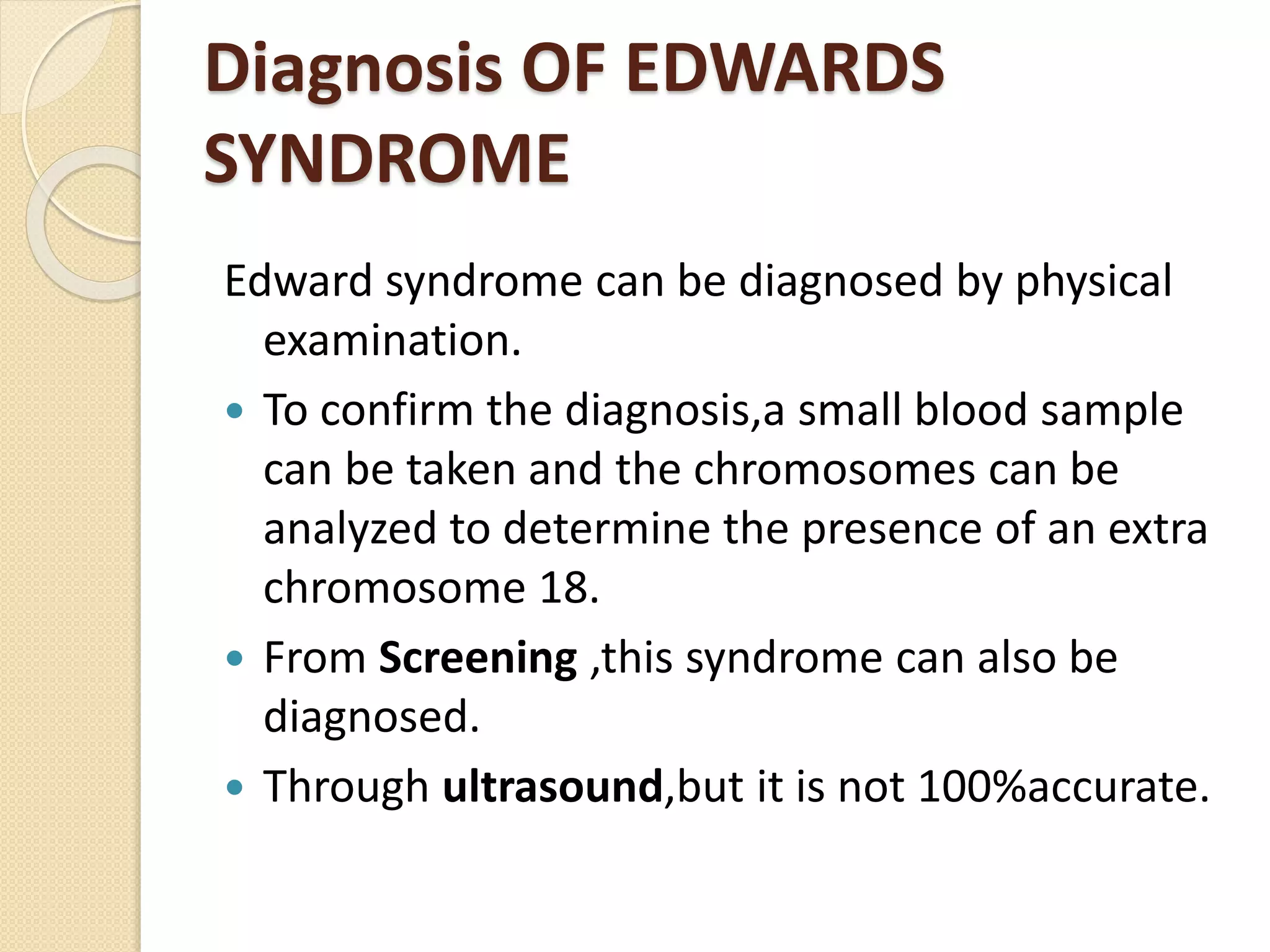 Edward syndrome | PPTX