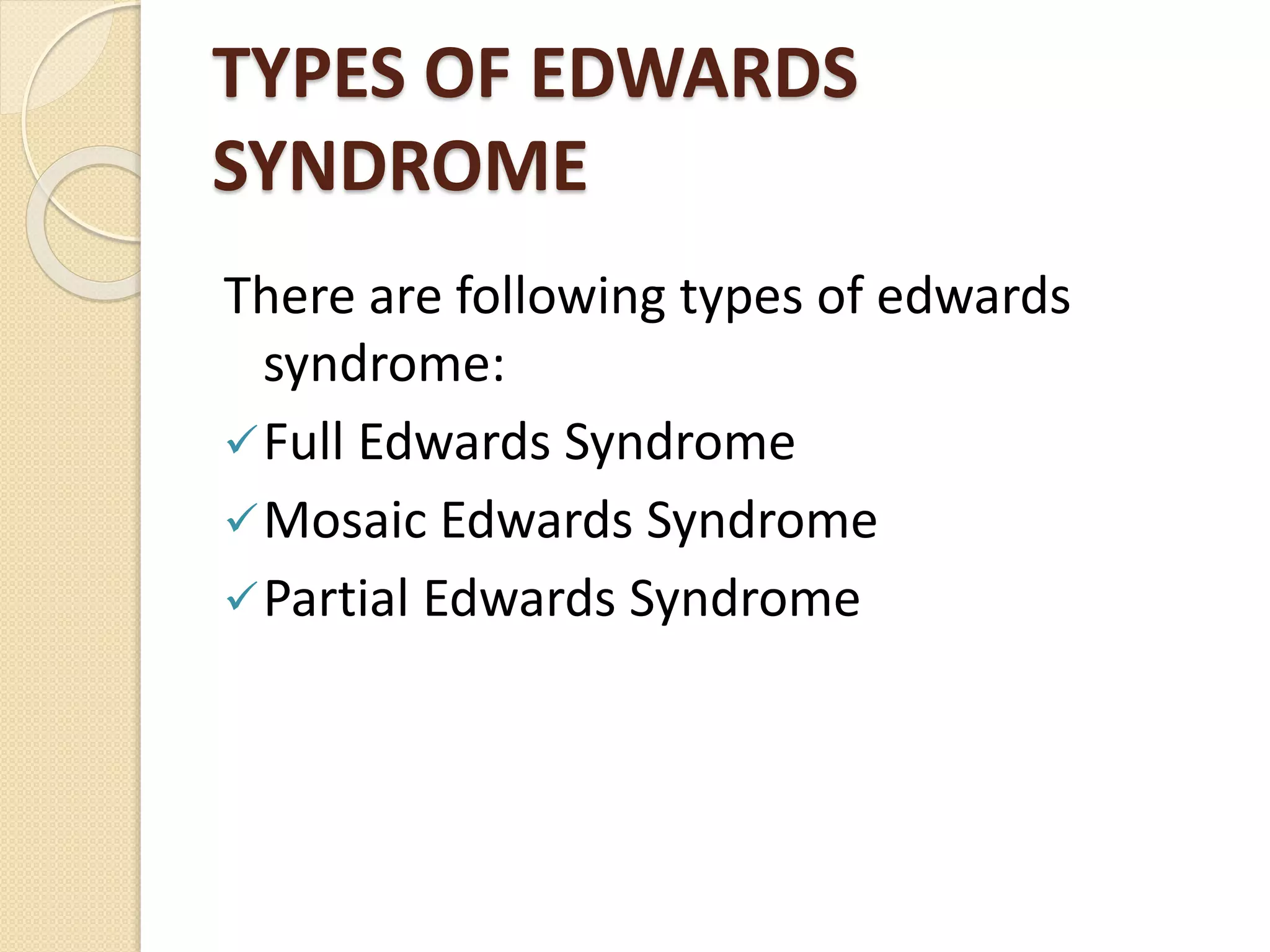 Edward syndrome | PPTX