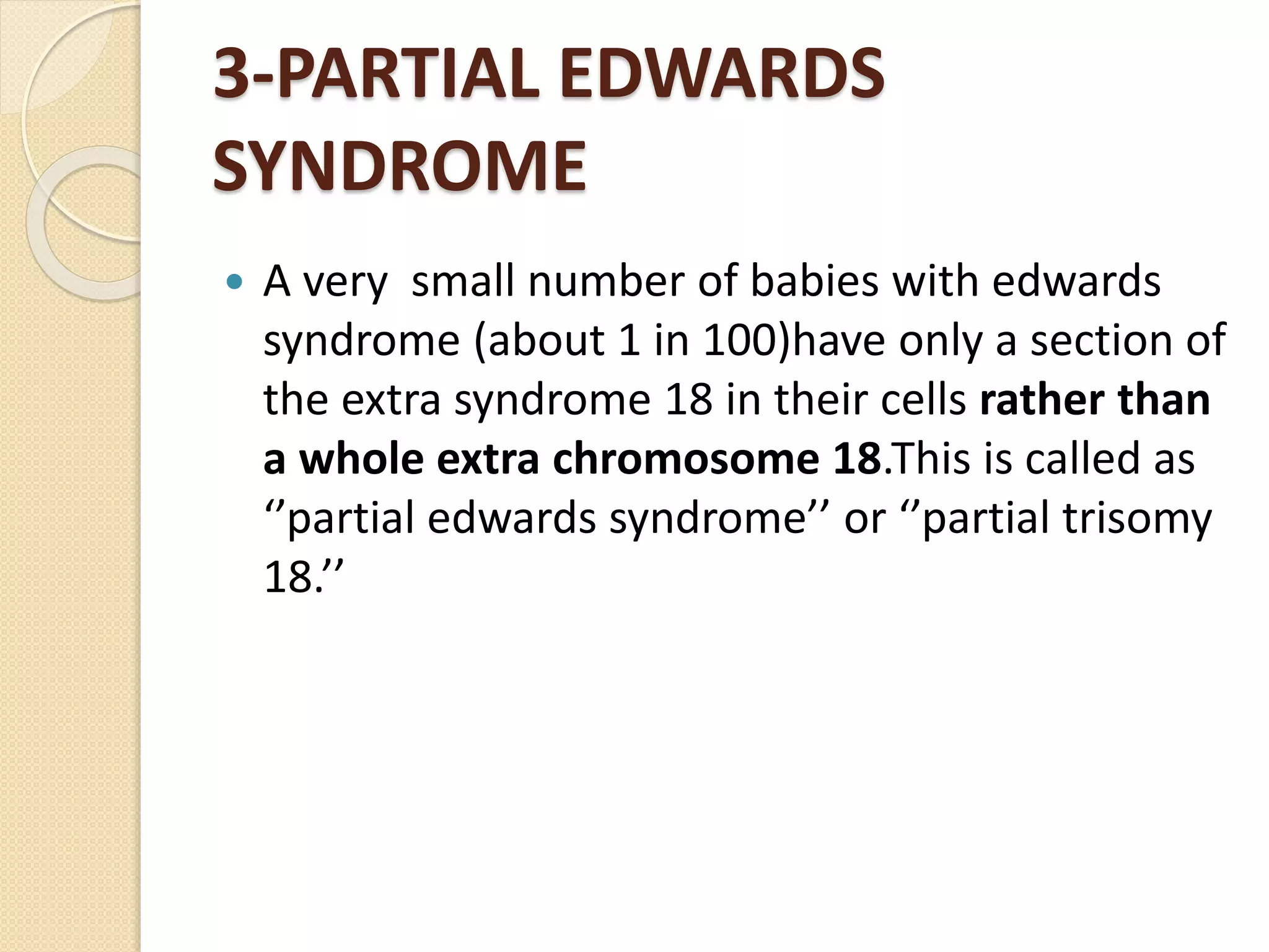 Edward syndrome | PPTX