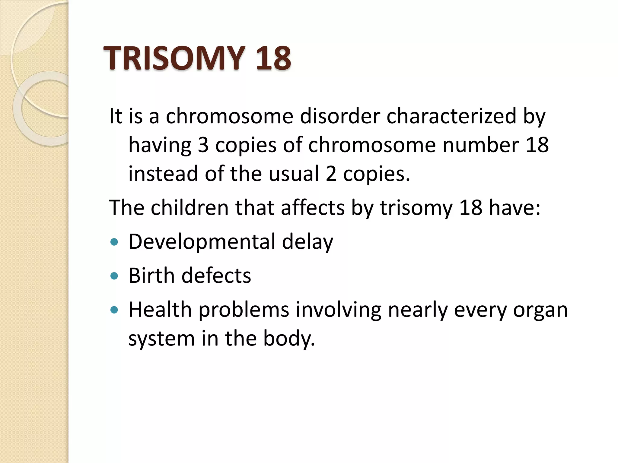 Edward syndrome | PPTX