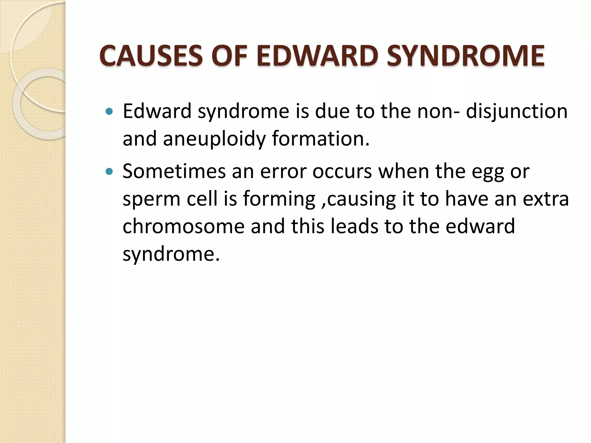 Edward syndrome | PPTX