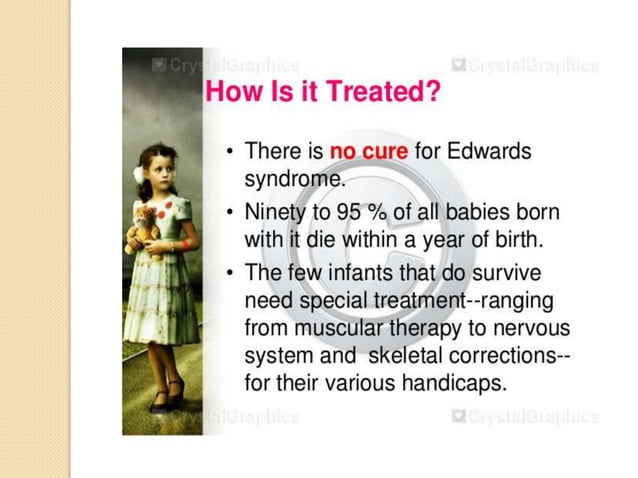 Edward syndrome | PPTX | Infertility | Reproductive Health