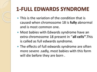 Edward syndrome | PPTX