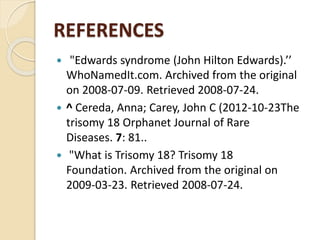 Edward syndrome | PPTX
