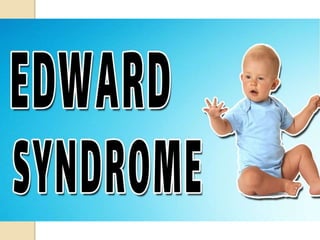 Edward syndrome | PPTX