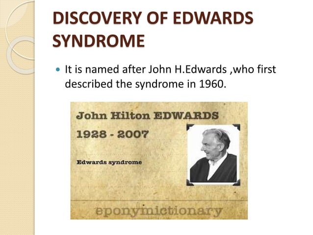 Edward syndrome | PPTX | Infertility | Reproductive Health