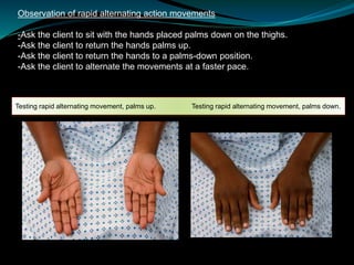 Rapid Alternating Movements
