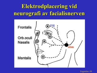 EDX Facialis | PPT