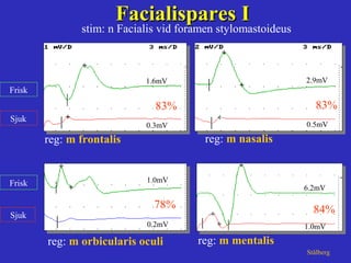 EDX Facialis | PPT | Brain and Nervous System Disorders | Diseases and ...