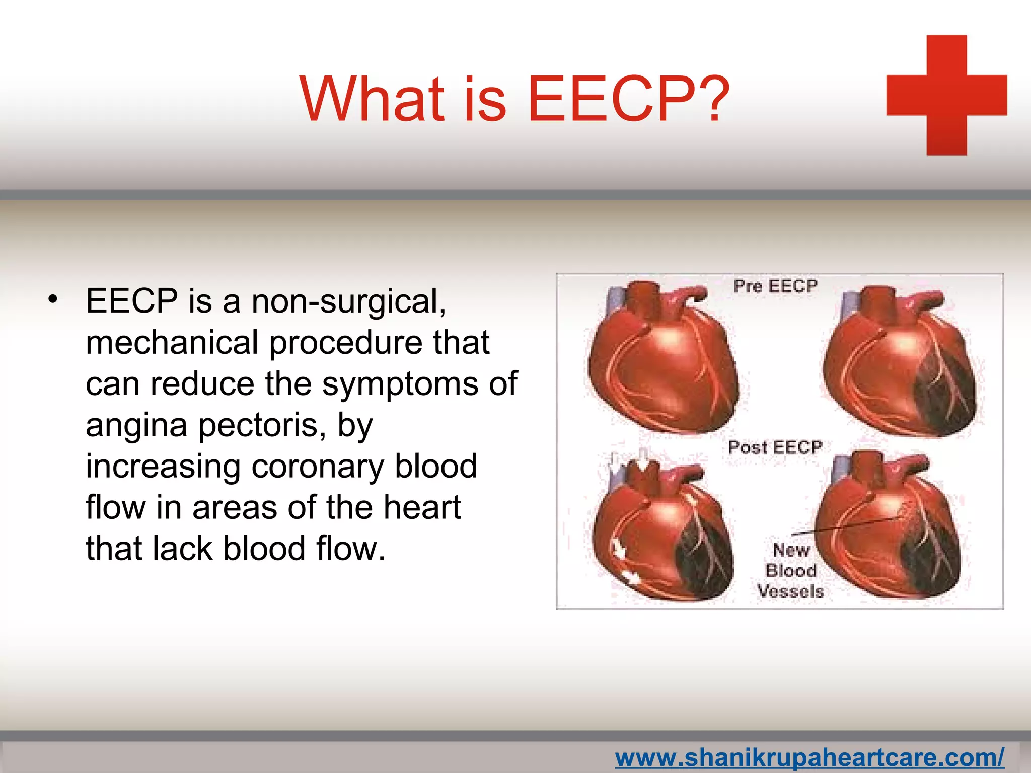 Eecp therapy in pune | PPT