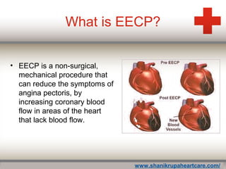Eecp therapy in pune | PPT