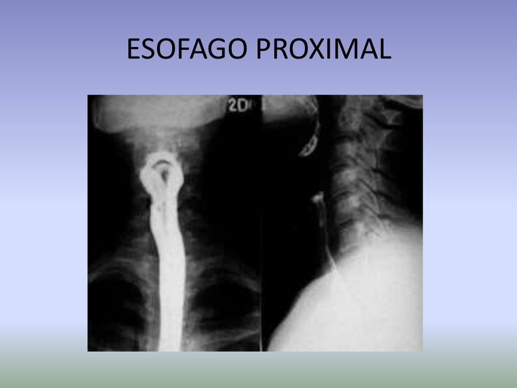Rx Esofago Hiato Estomago E Duodeno - RETOEDU