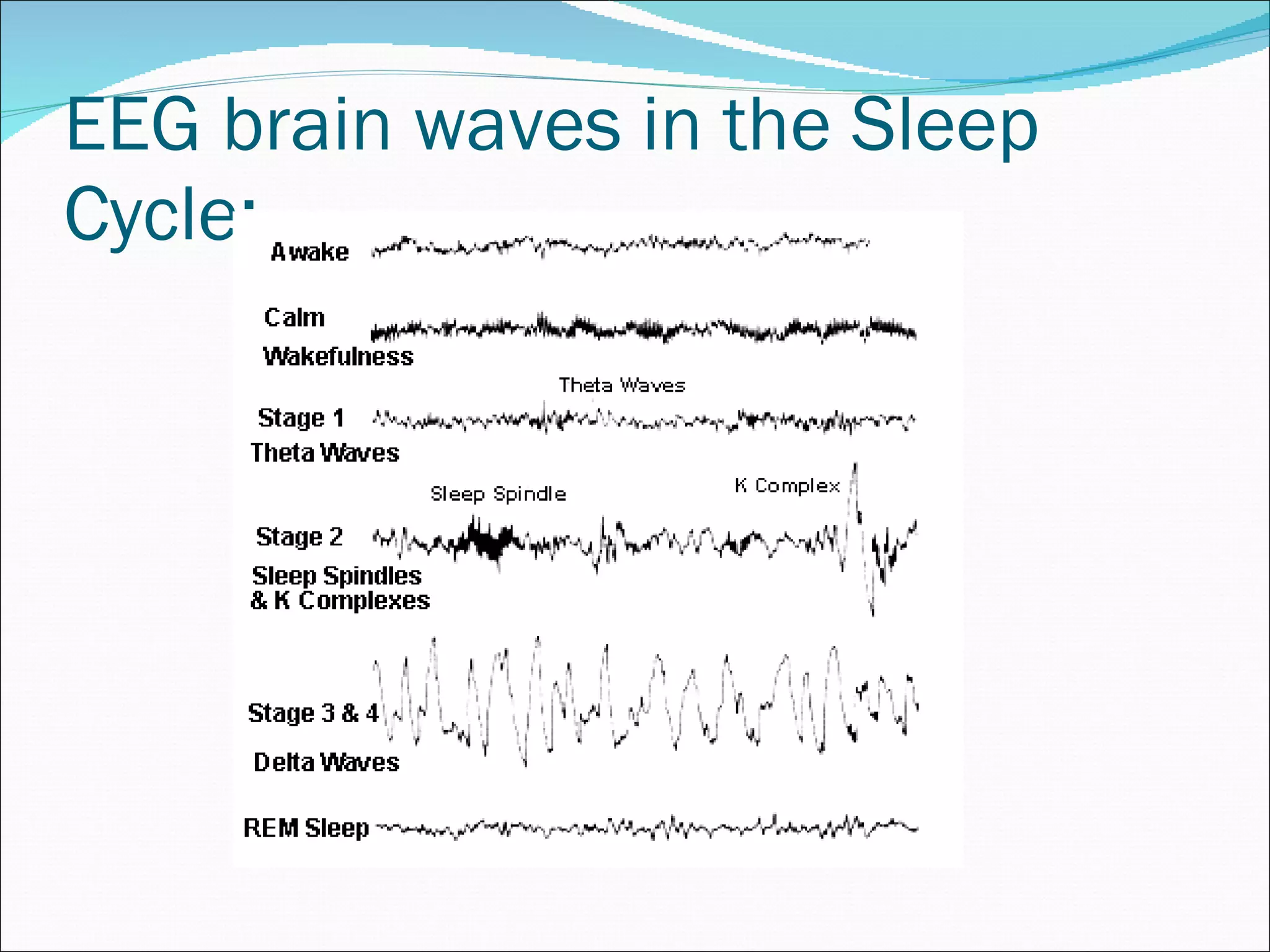 EEG: Basics | PPT