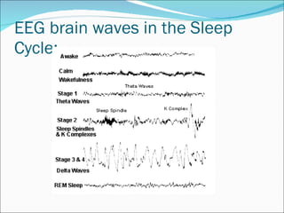 EEG: Basics | PPT
