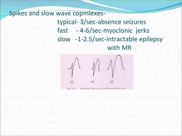 EEG: Basics | PPT