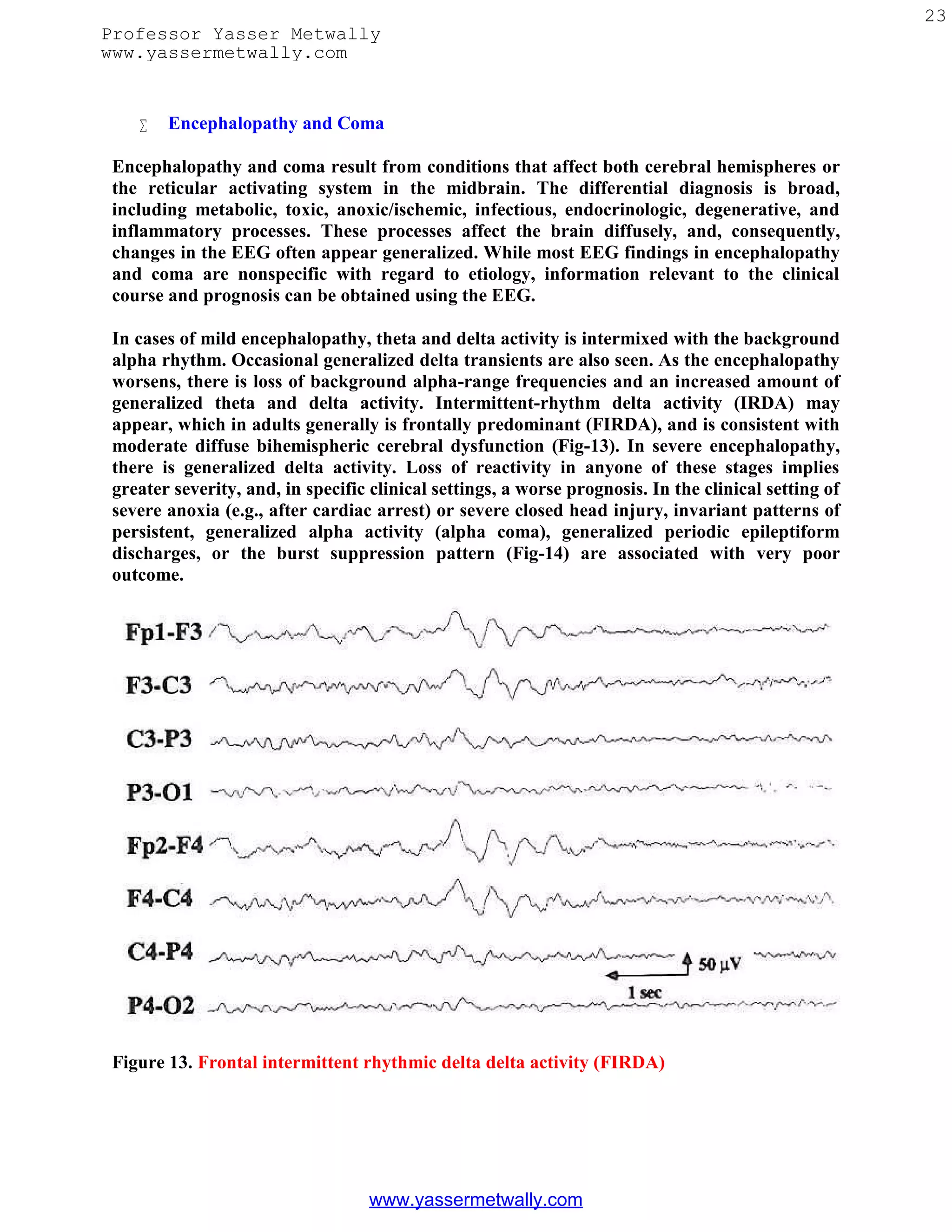 Textbook of electroencephalography | PDF