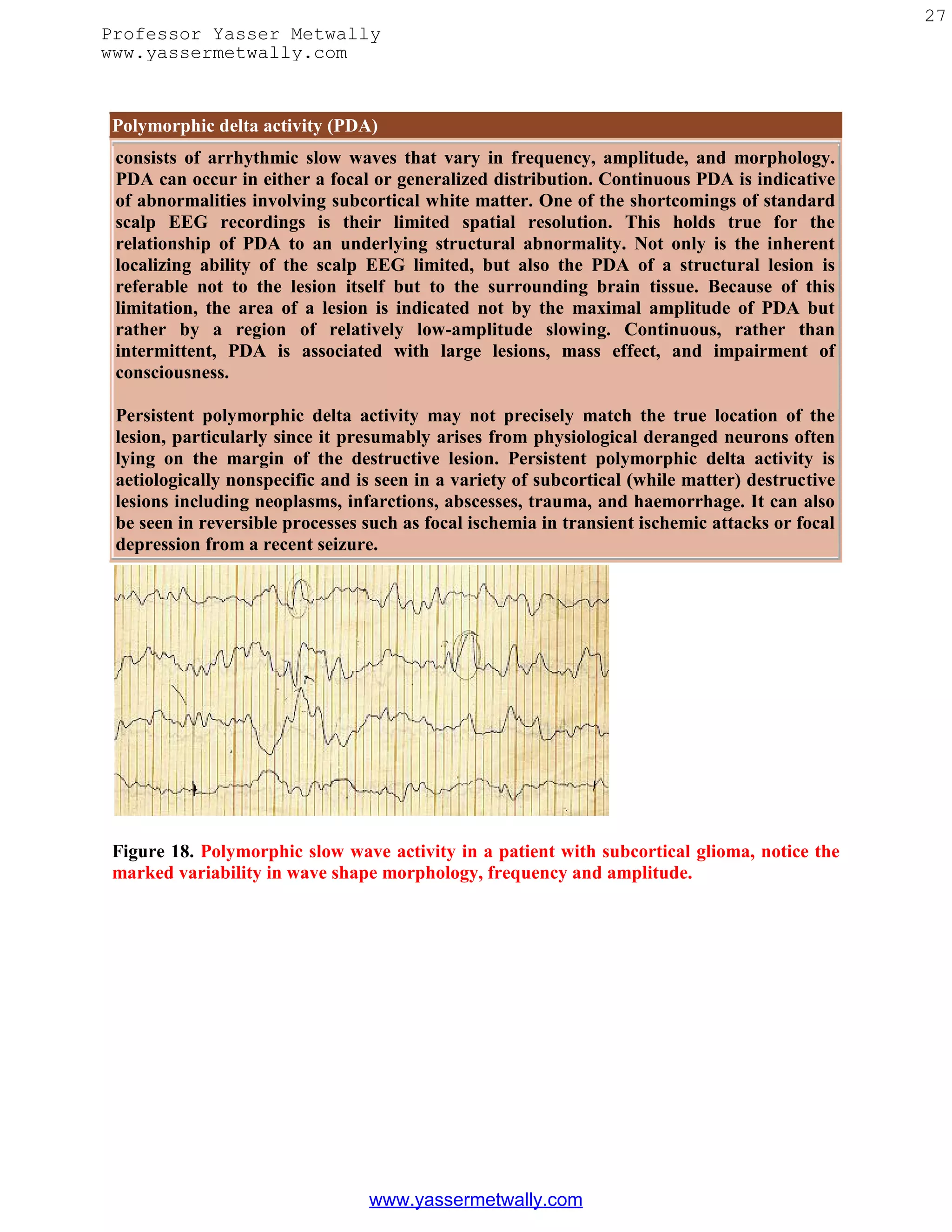 Textbook of electroencephalography | PDF