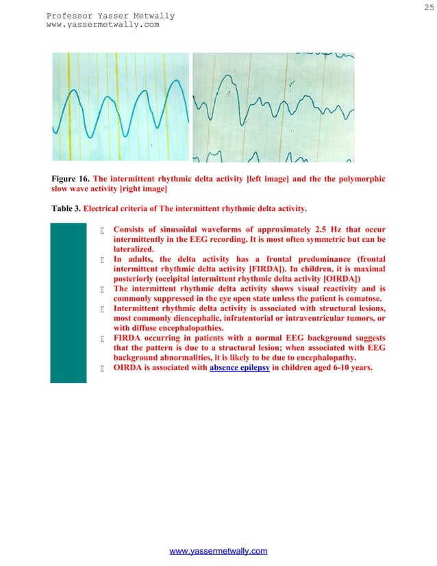 Textbook of electroencephalography | PDF