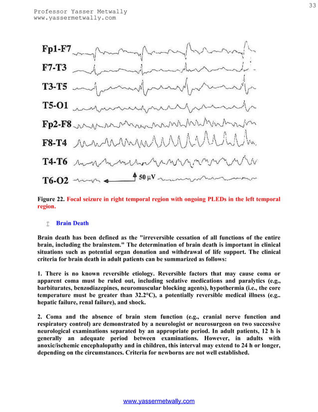 Textbook of electroencephalography | PDF