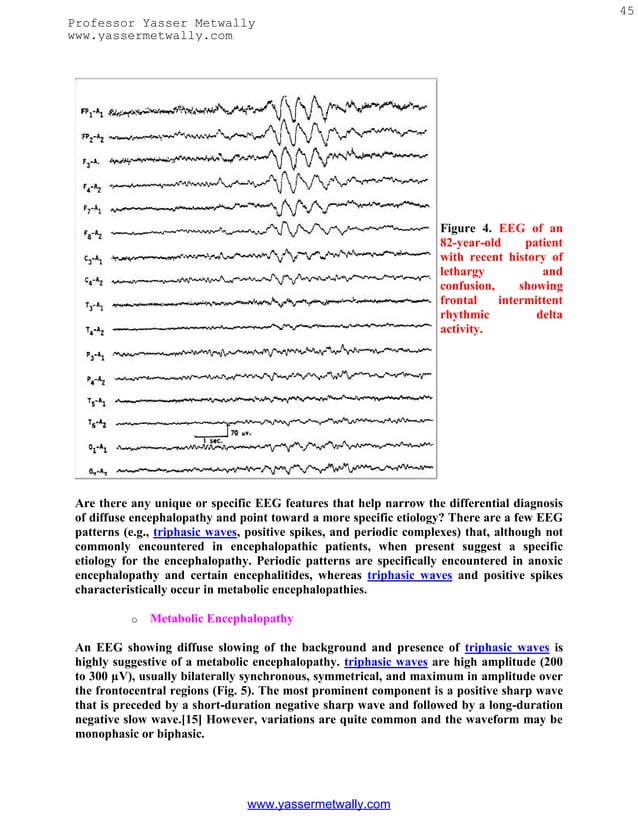 Textbook of electroencephalography | PDF