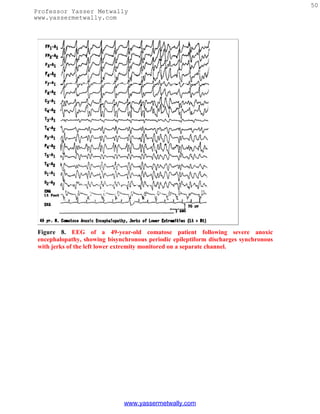 Textbook of electroencephalography | PDF