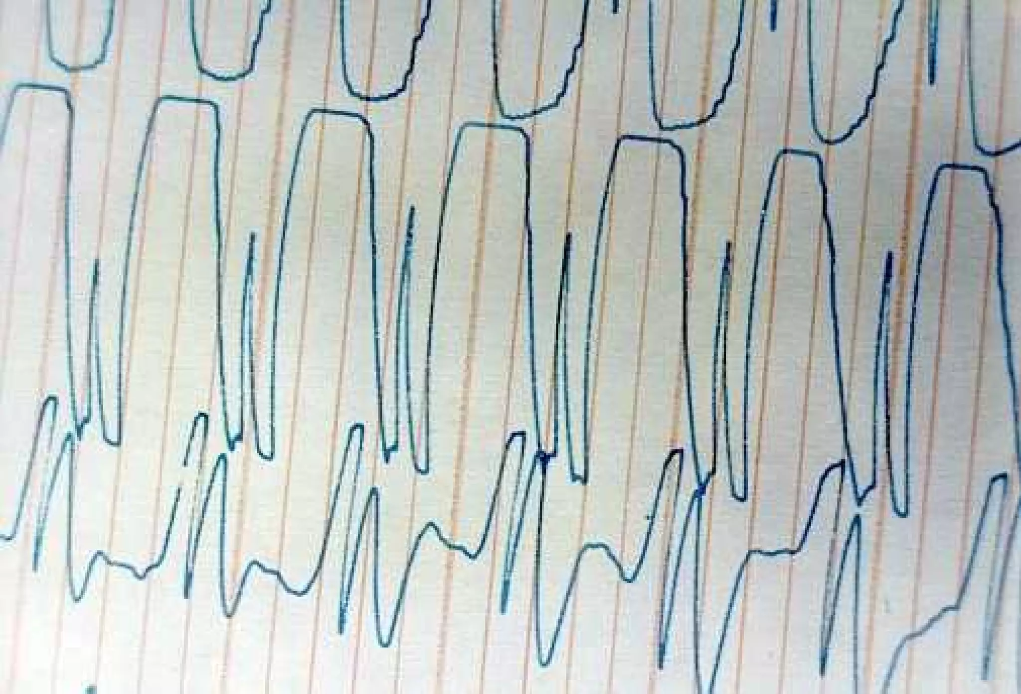 Definition of Some conventional EEG terminologies | PPT