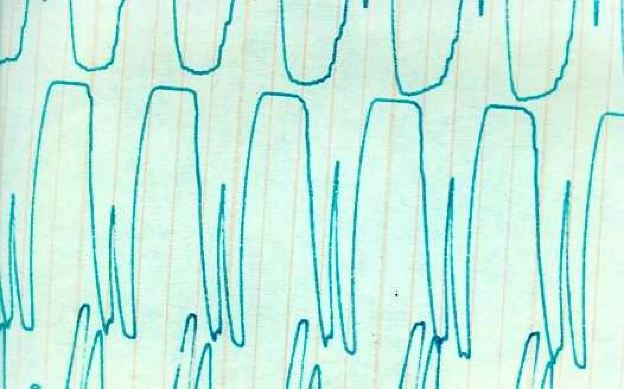 Definition of Some conventional EEG terminologies | PPT