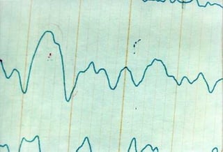 Definition of Some conventional EEG terminologies | PPT