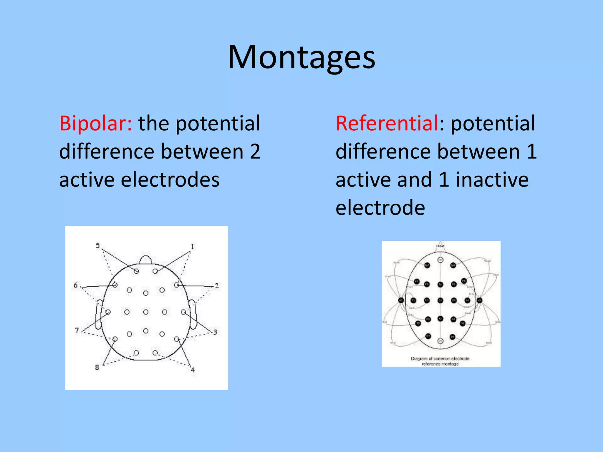 Eeg in pediatric (DNB PEDIATRIC) | PPTX