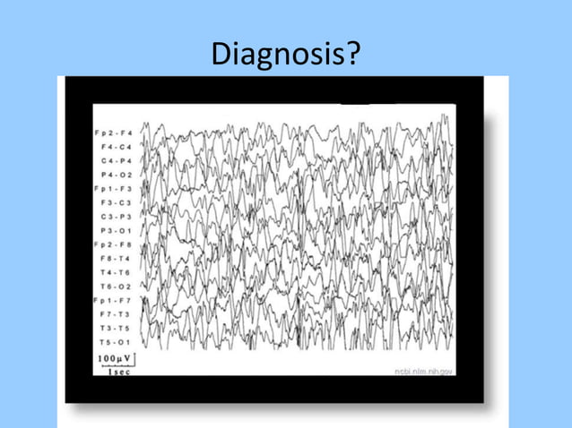 Eeg In Pediatric Dnb Pediatric