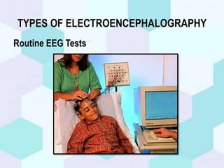 ELECTROENCEPHALOGRAM/ ELECTROENCEPHALOGRAPHY | PPTX