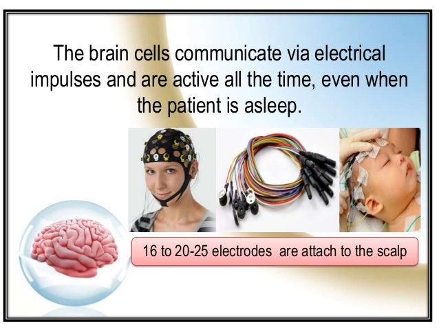 Electroencephalogram Suffix