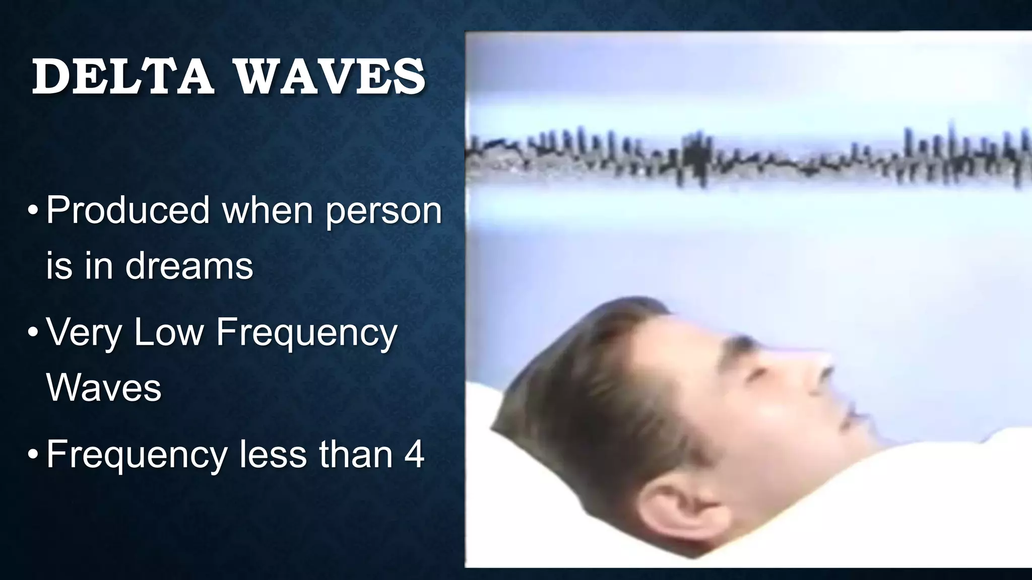 Eeg & Brainwave Robotics | PPT