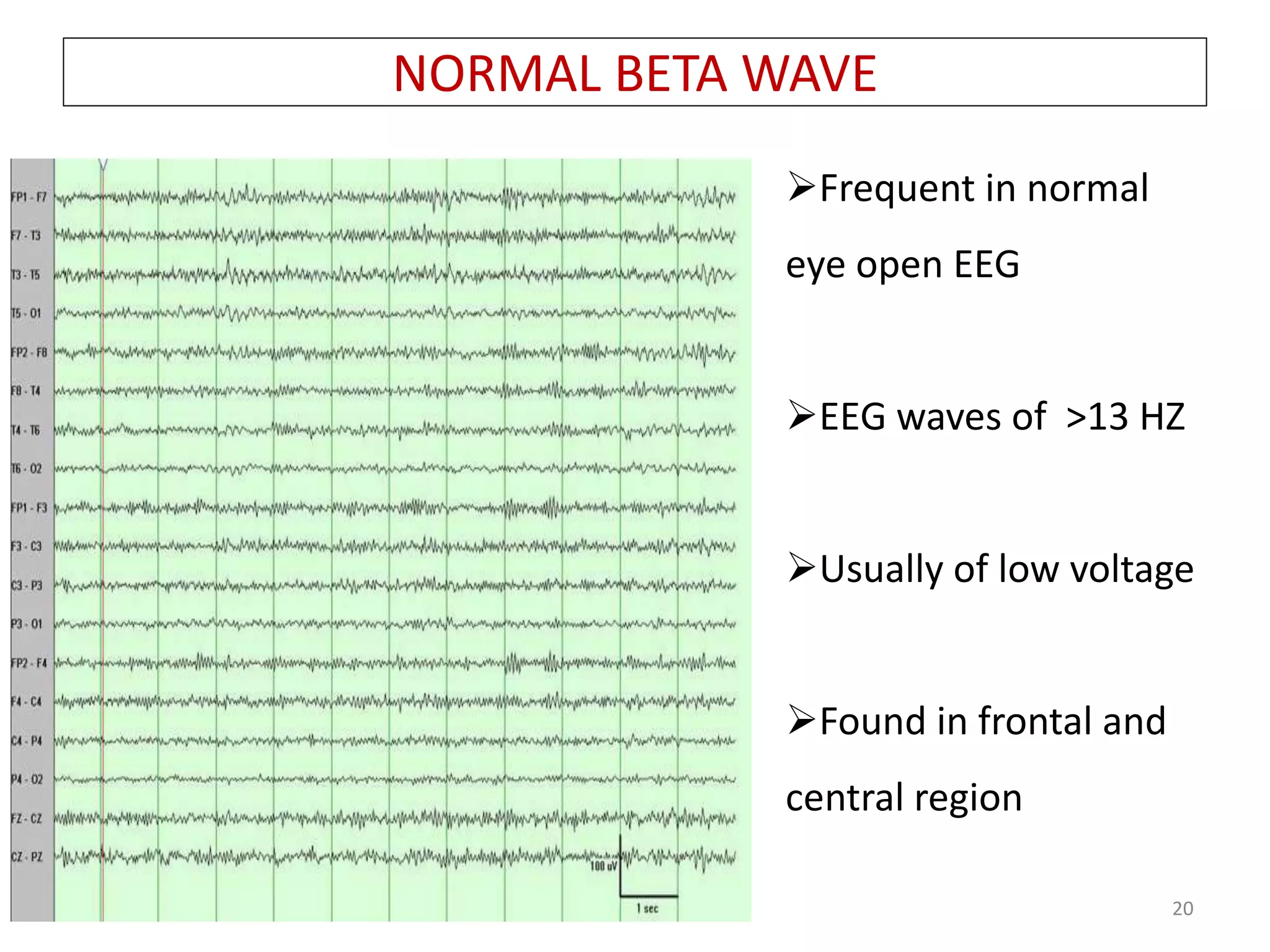 EEG in neurology and psychiatry | PPTX