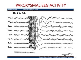 EEG in neurology and psychiatry | PPTX