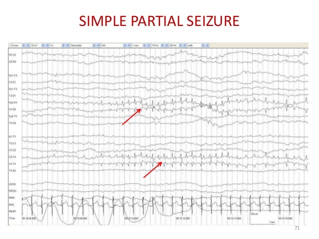 EEG in neurology and psychiatry