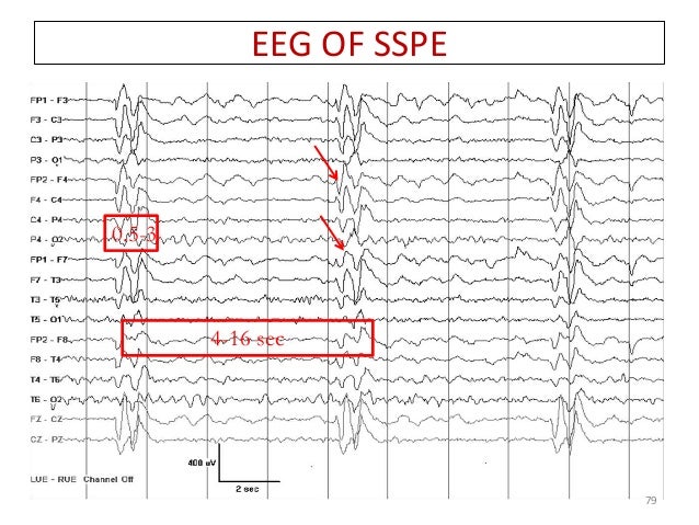 EEG in neurology and psychiatry