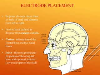 eeg-17112611154112428491152828379272737.pdf