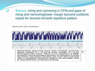 Amplitude - INTEGRATED( aEEG) | PPTX | Pregnancy | Reproductive Health