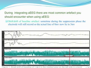 Amplitude - INTEGRATED( aEEG) | PPTX