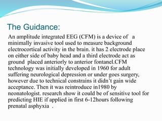 Amplitude - INTEGRATED( aEEG) | PPTX