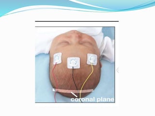 Amplitude - INTEGRATED( aEEG) | PPTX | Pregnancy | Reproductive Health