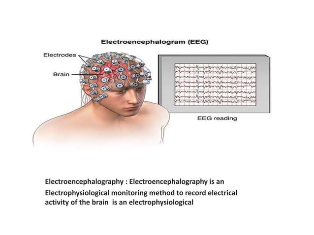 EEG-Based Drowsiness Estimation for Safety Driving | PPTX