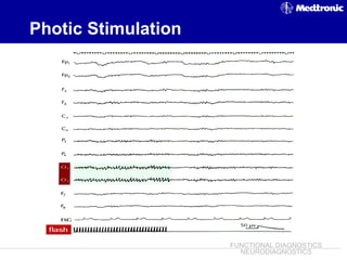 EEG ~ Dr. Tarek Asaad | PPT