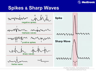 EEG ~ Dr. Tarek Asaad | PPT