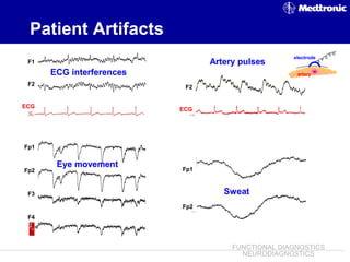 EEG ~ Dr. Tarek Asaad | PPT