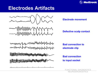 EEG ~ Dr. Tarek Asaad | PPT